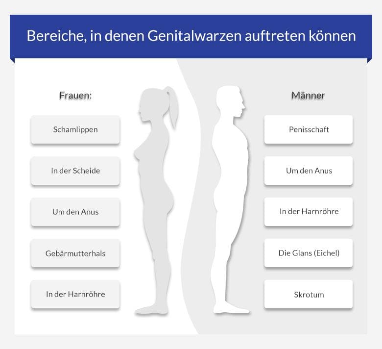 Behandlung Von Feigwarzen Im Genitalbereich – SFJO
