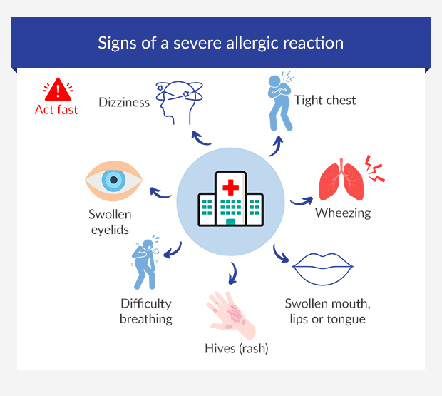 Fluconazole • Effective thrush treatment