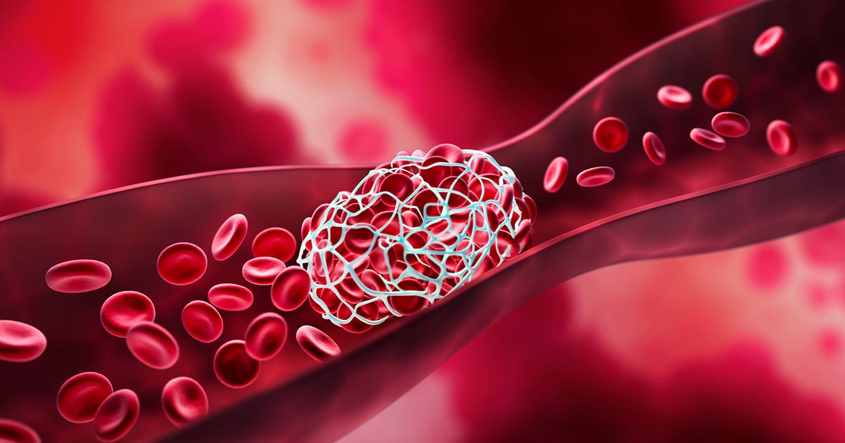 Voivatko vanhemmat naiset käyttää hormonaalista ehkäisyä? • euroClinix®