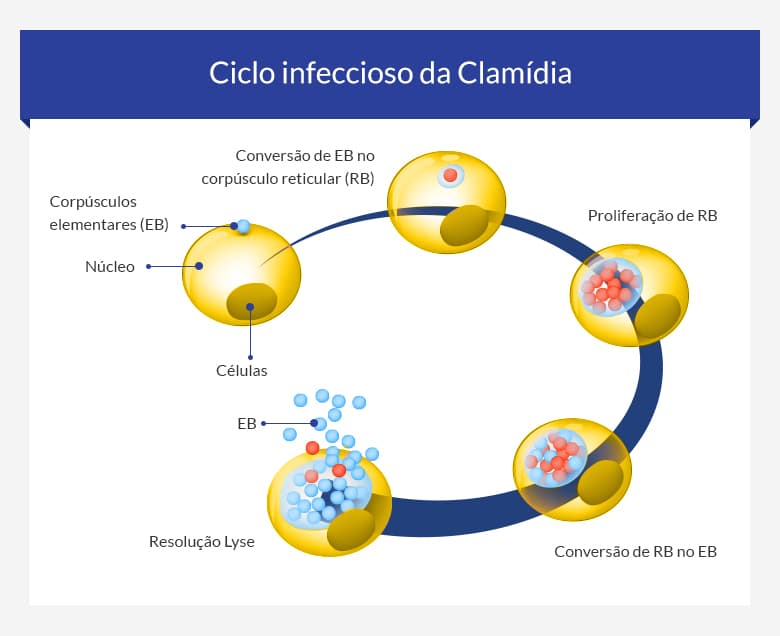 Clamídia | Sintomas e Tratamentos da Chlamydia Trachomatis