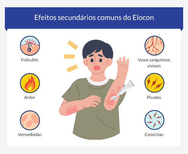Elocon creme e pomada • Psoríase e eczema