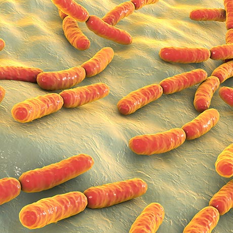 Urinvägsinfektion • Symptom, orsaker och behandling • euroClinix®